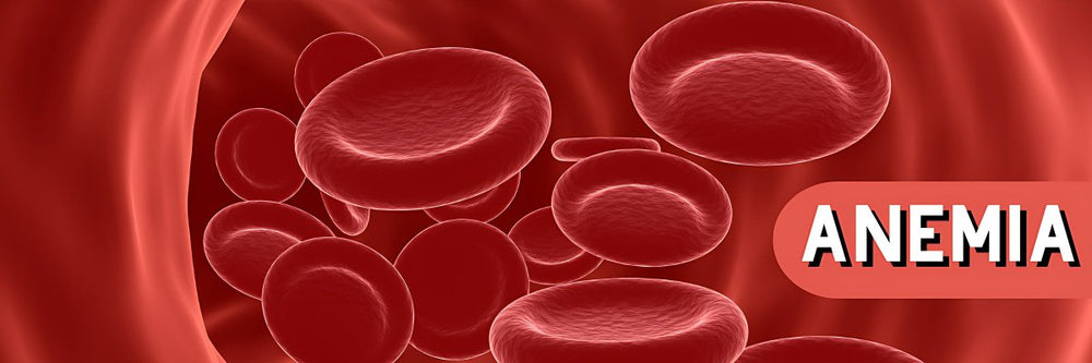 Causes of Anemia and its Remedy Anemia
