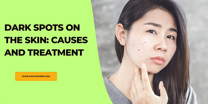 Dark spots on the skin: causes and treatment